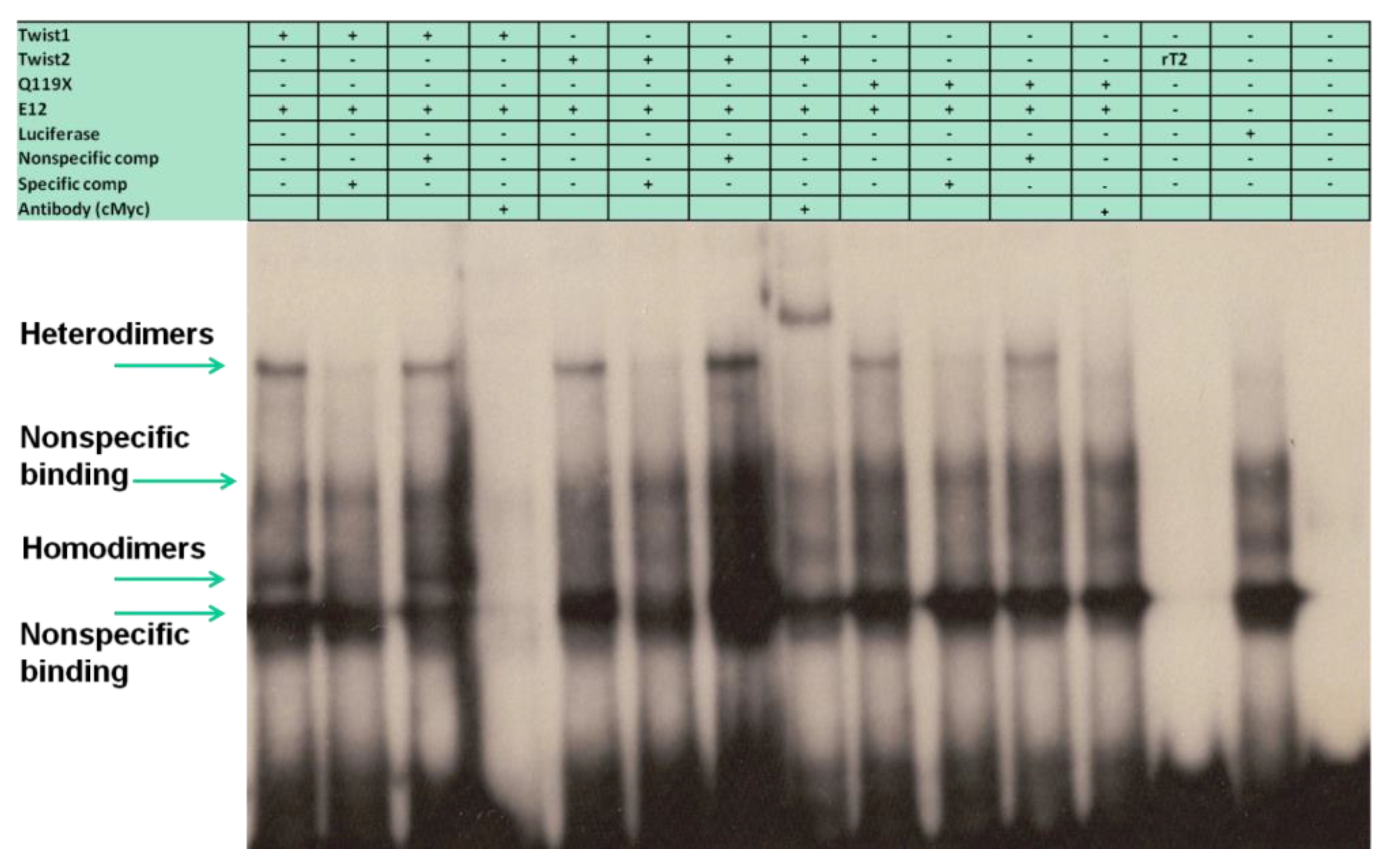 Mechanisms of Regulation of the CHRDL1 Gene by the TWIST2 and ADD1 ...