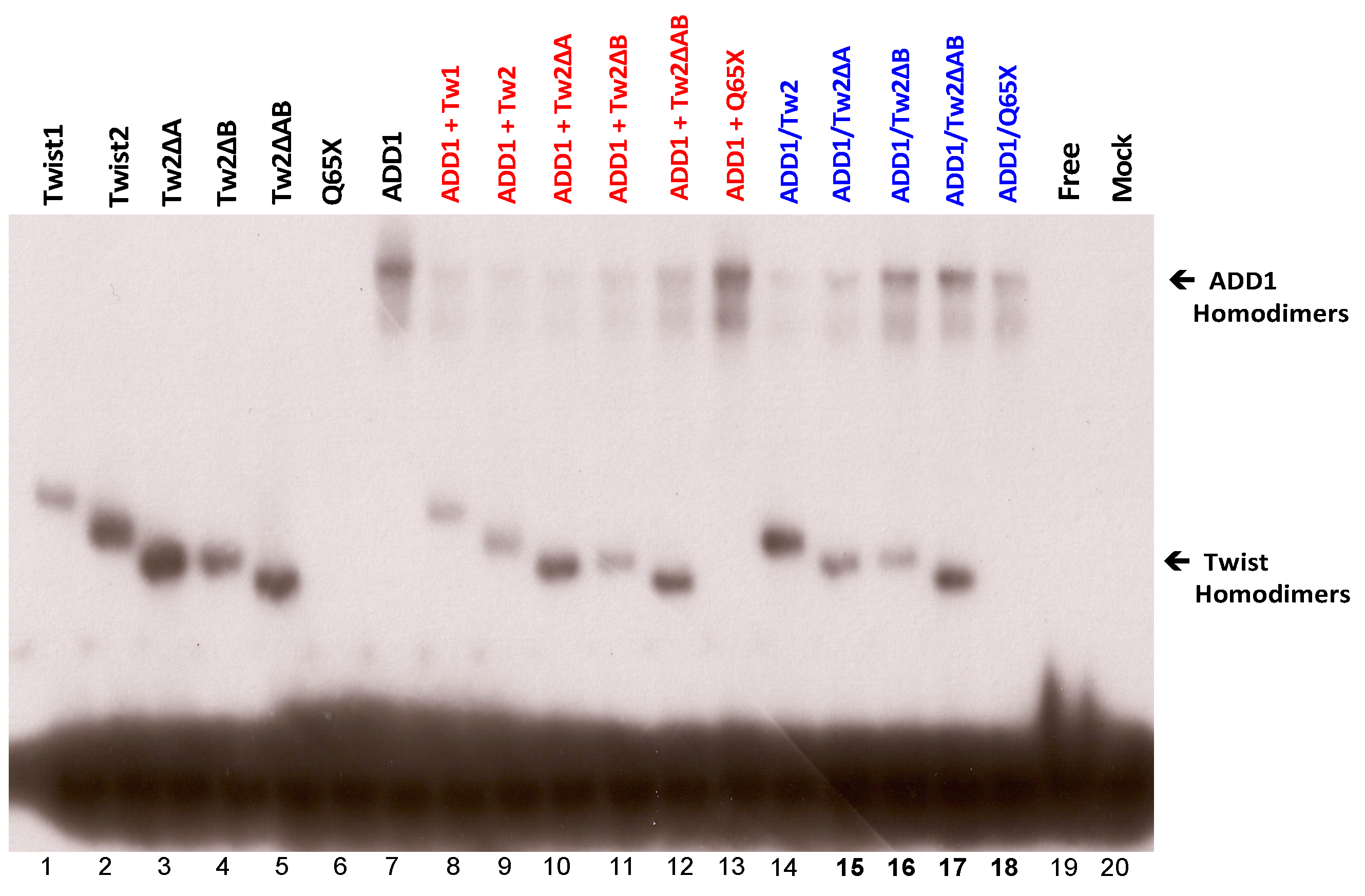 Mechanisms of Regulation of the CHRDL1 Gene by the TWIST2 and ADD1 ...