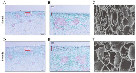 Transcriptome and Physiological Analysis Highlight Lignin Metabolism of ...