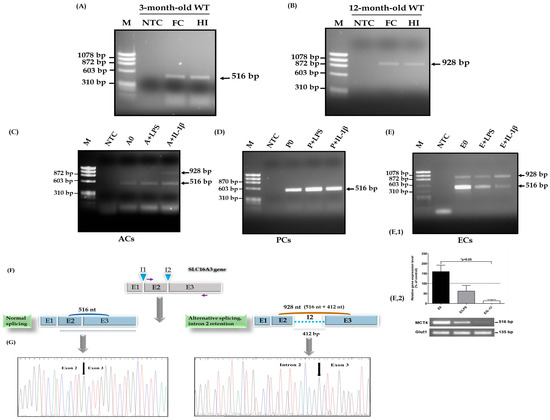 Identification of Intron Retention in the Slc16a3 Gene Transcript ...