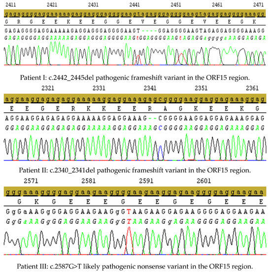 Identification of the RPGR Gene Pathogenic Variants in a Cohort of ...