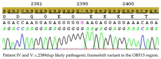 Identification of the RPGR Gene Pathogenic Variants in a Cohort of ...