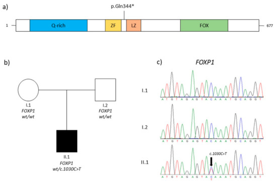 Genes | Free Full-Text | Identification of a Novel FOXP1 Variant in a ...