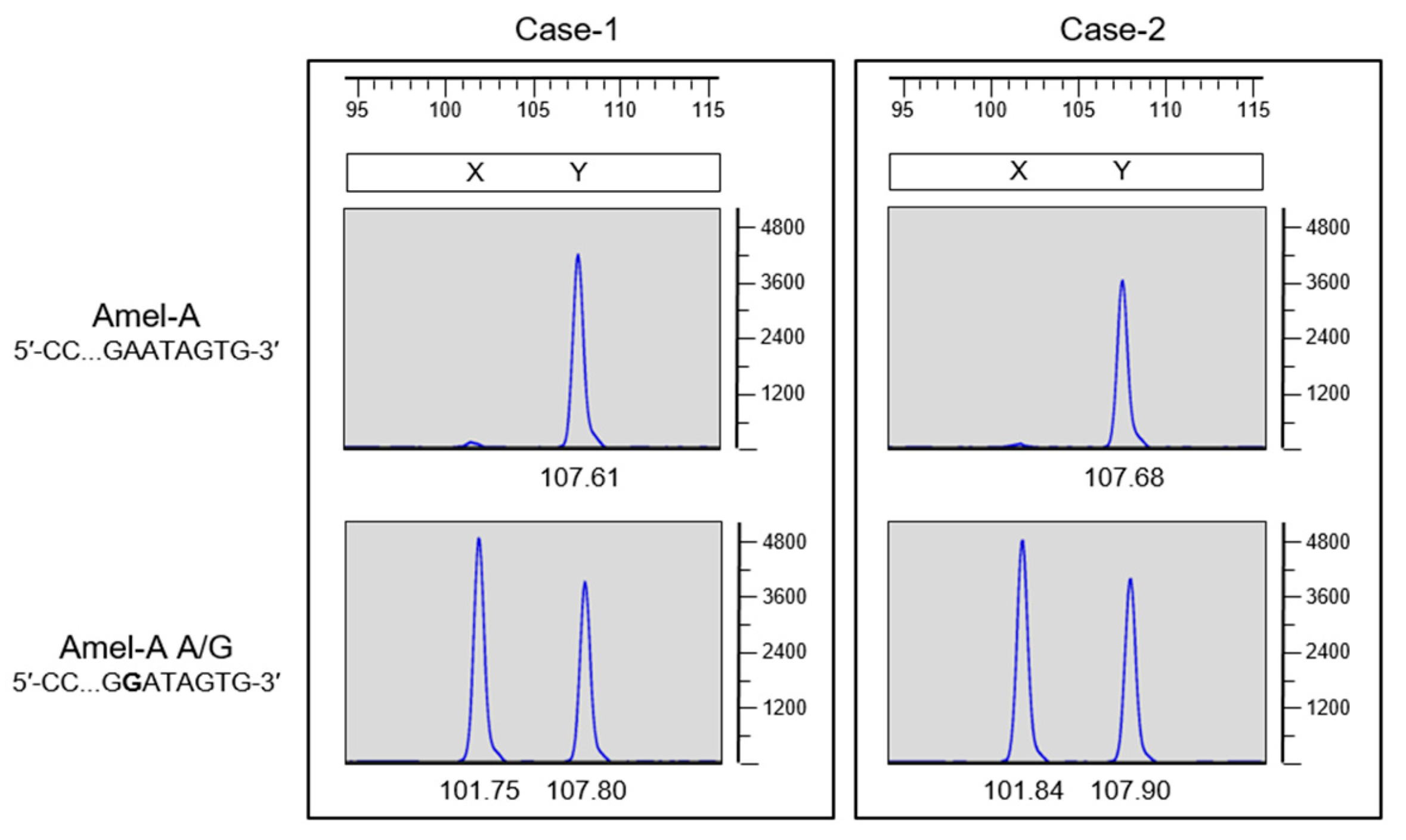 Amplification Failure of the Amelogenin X Gene Caused by a Rare ...