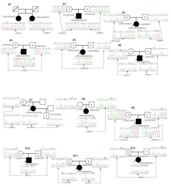 Genes | Free Full-Text | A Molecular Genetic Analysis of RPE65 ...