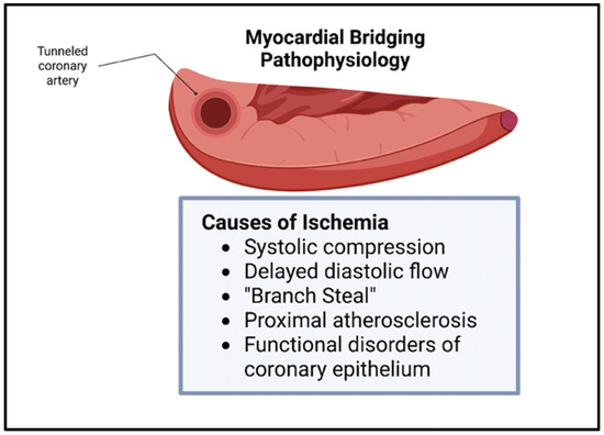 A Contemporary Review of the Genomic Associations of Coronary Artery ...