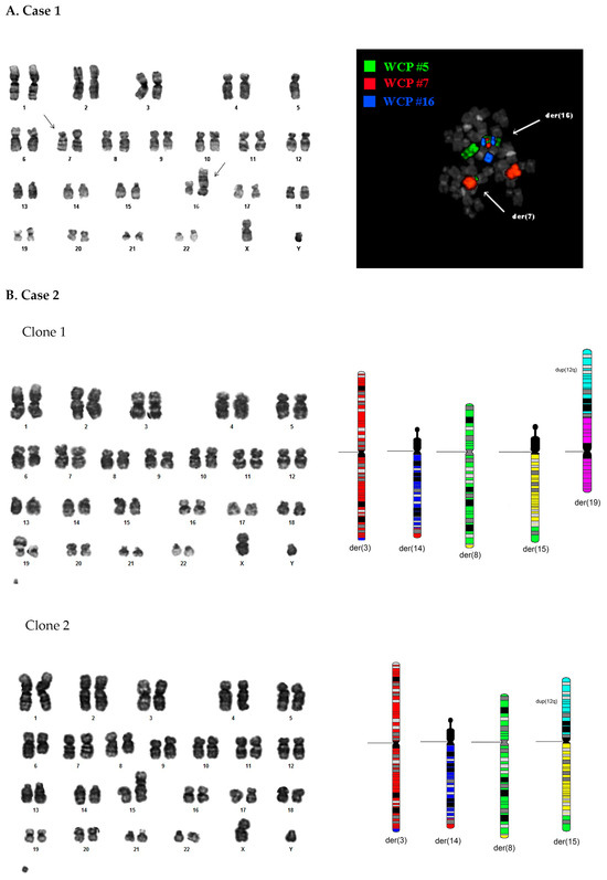 Optical Genome Mapping as a Tool to Unveil New Molecular Findings in ...