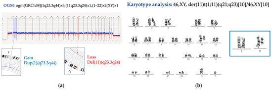 Optical Genome Mapping as a New Tool to Overcome Conventional ...