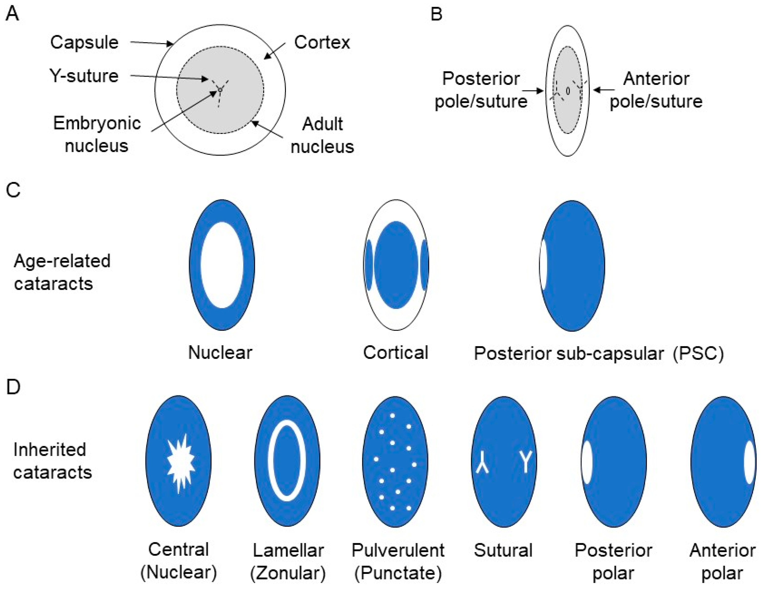 Through the Cat-Map Gateway: A Brief History of Cataract Genetics