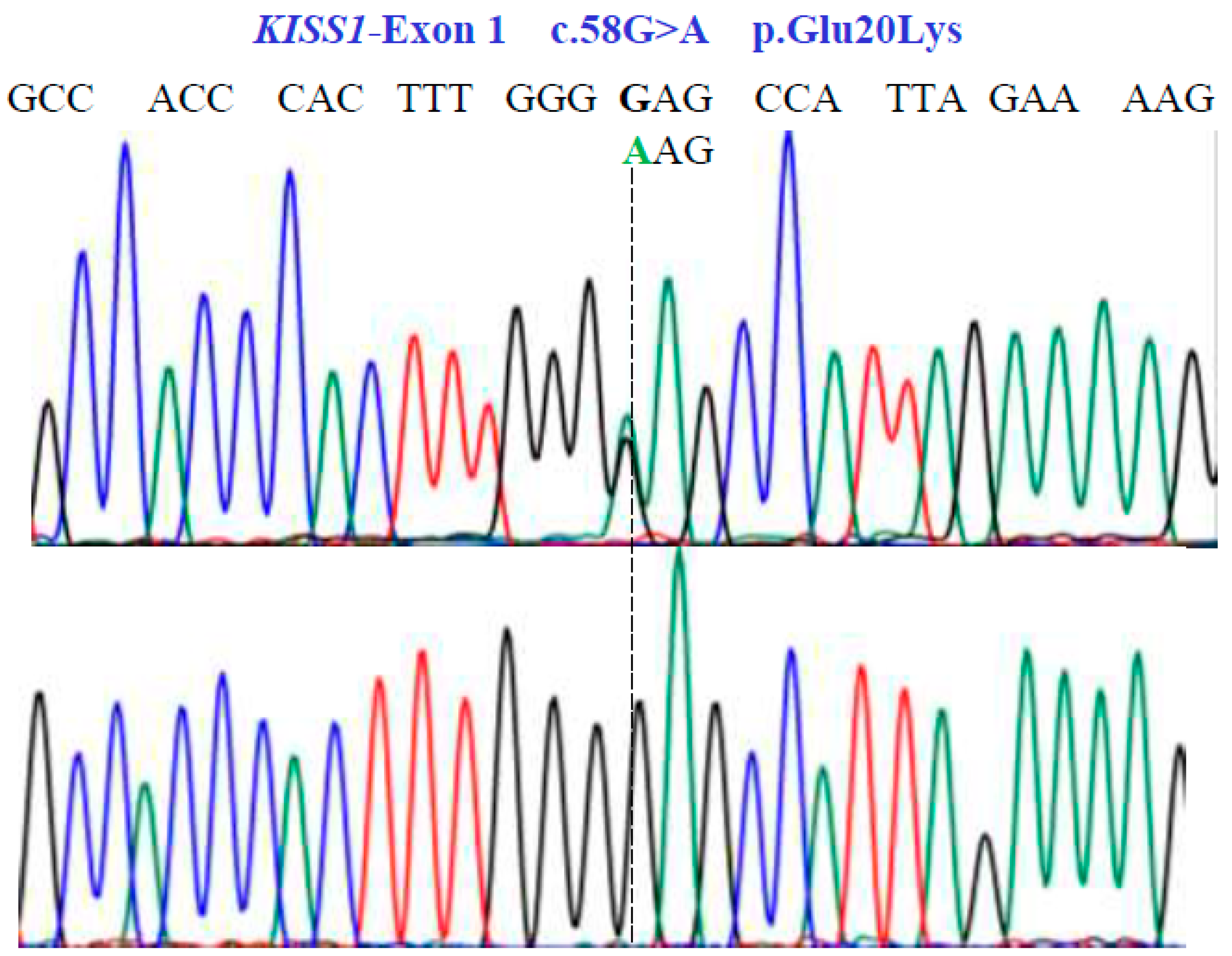Genetic Variants in KNDy Pathway Lack Association with Premature ...