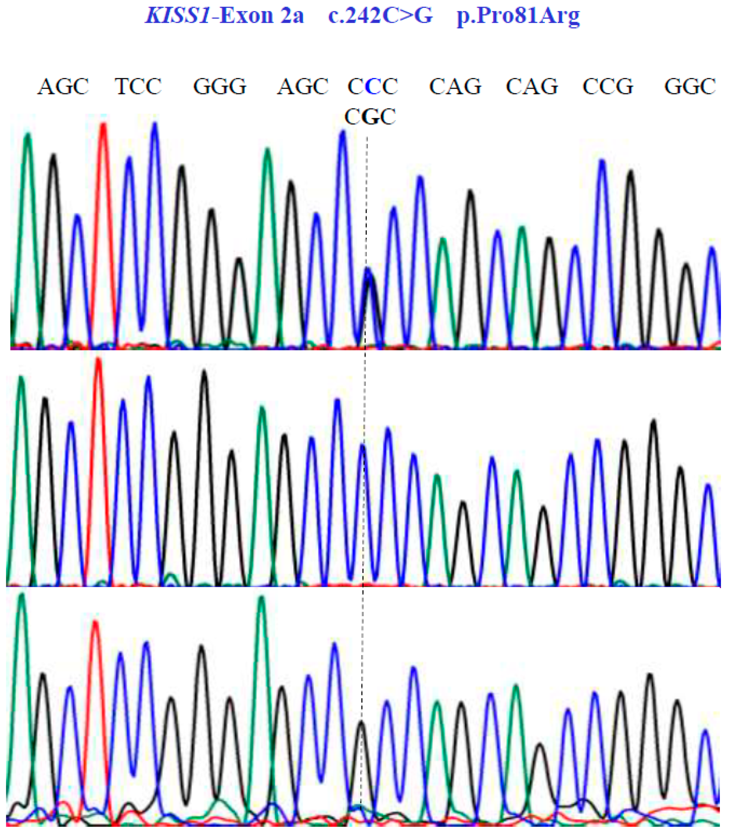 Genetic Variants in KNDy Pathway Lack Association with Premature ...