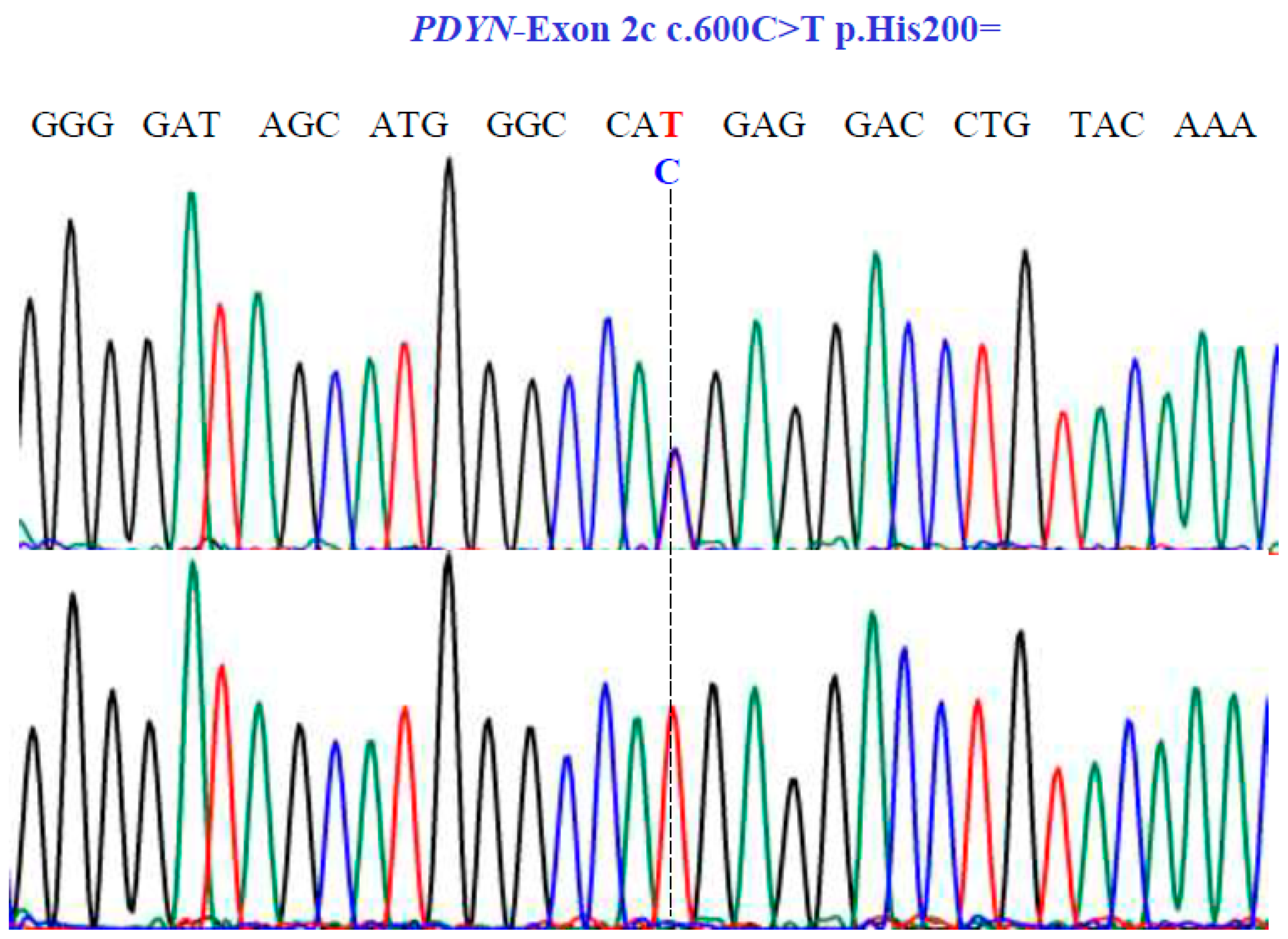 Genetic Variants in KNDy Pathway Lack Association with Premature ...