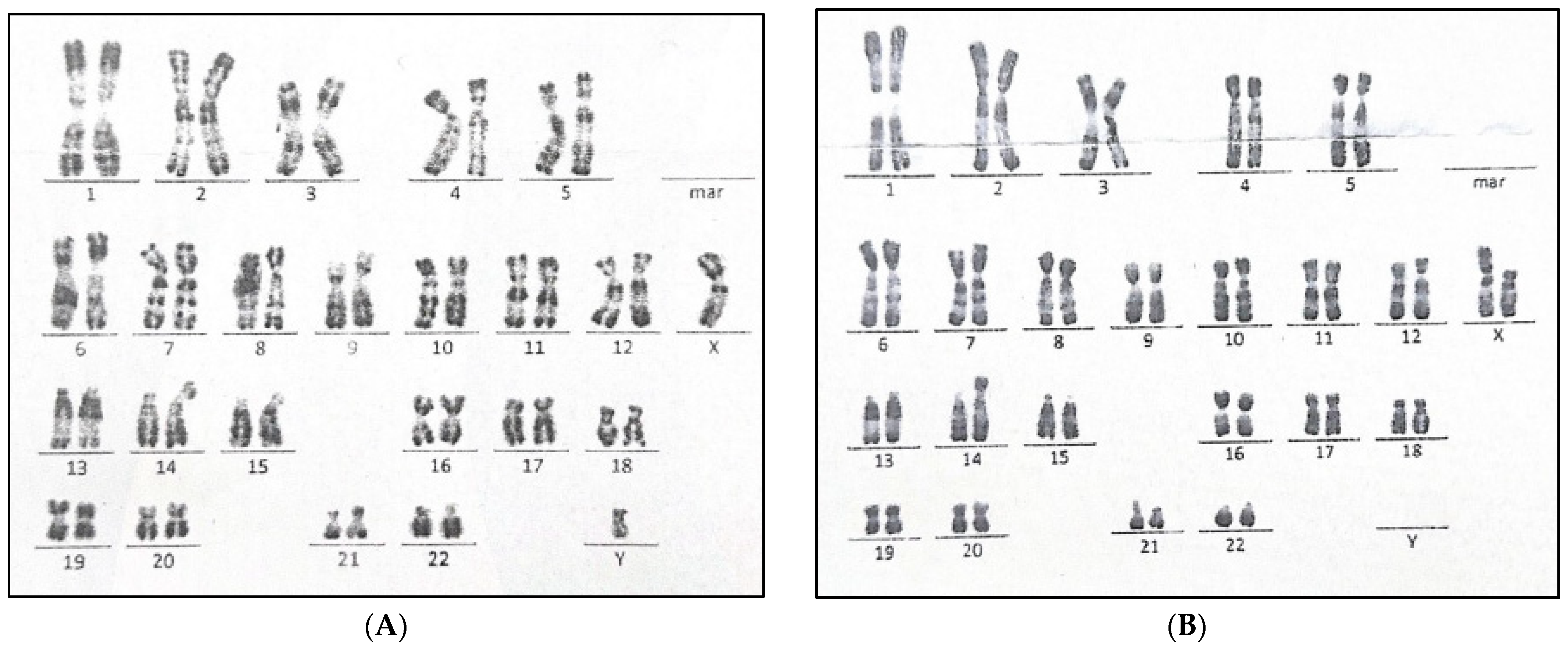 Genes | Free Full-Text | CNV Analysis through Exome Sequencing Reveals ... Genes | Free Full-Text | CNV Analysis through Exome Sequencing Reveals ...