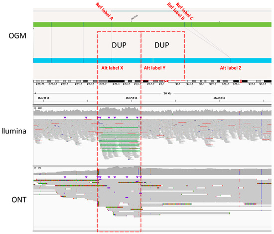A Comparison of Structural Variant Calling from Short-Read and Nanopore-Based Whole-Genome ...