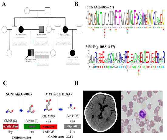 Exploring the Genotype–Phenotype Correlations in a Child with Inherited ...