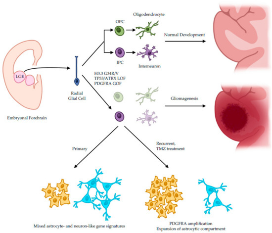 Pediatric Hemispheric High-Grade Gliomas and H3.3-G34 Mutation: A Review of the Literature on ...