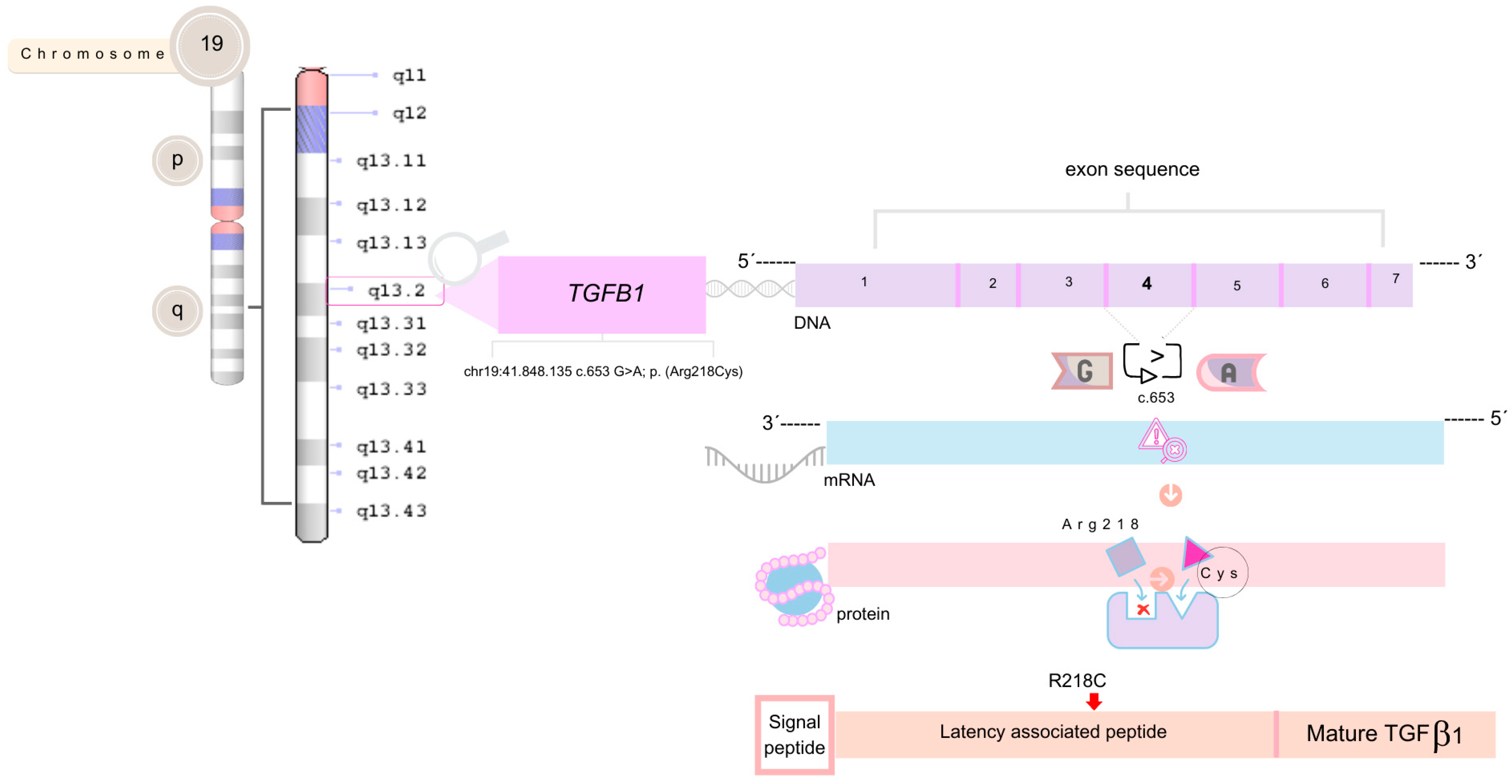 Phenotypic Variability in Camurati–Engelmann Disease: A Case Report of ...