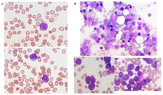 Optical Genome Mapping Reveals Complex and Cryptic Rearrangement ...