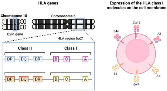 Loss of Heterozygosity (LOH) Affecting HLA Genes in Breast Cancer ...