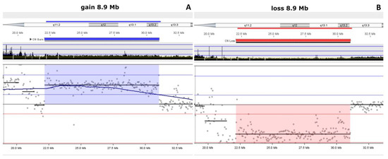 Clinical and Cytogenetic Impact of Maternal Balanced Double ...