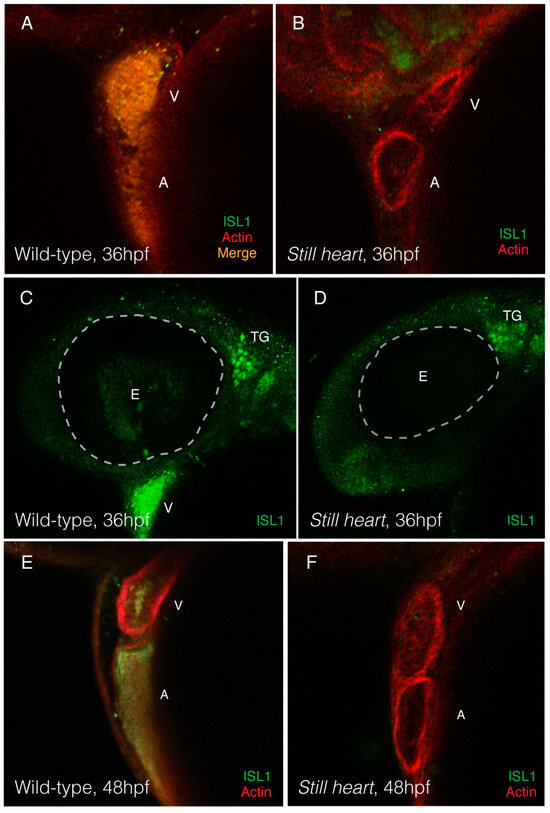 Heart Morphogenesis Requires Smyd1b for Proper Incorporation of the ...