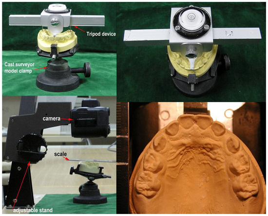 Fluctuating Genetic Influences at Three Different Stages of Development ...