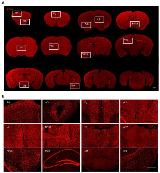 Neuronal Network Activation Induced by Forniceal Deep Brain Stimulation ...