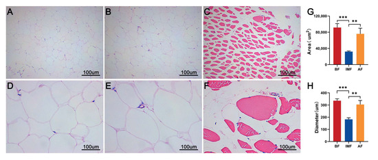 Analysis of Transcriptome Differences Between Subcutaneous and ...