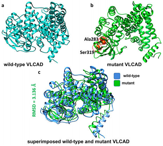 ACADVL Deep Sequencing in a Case Study: Beyond the Common c.848T>C ...