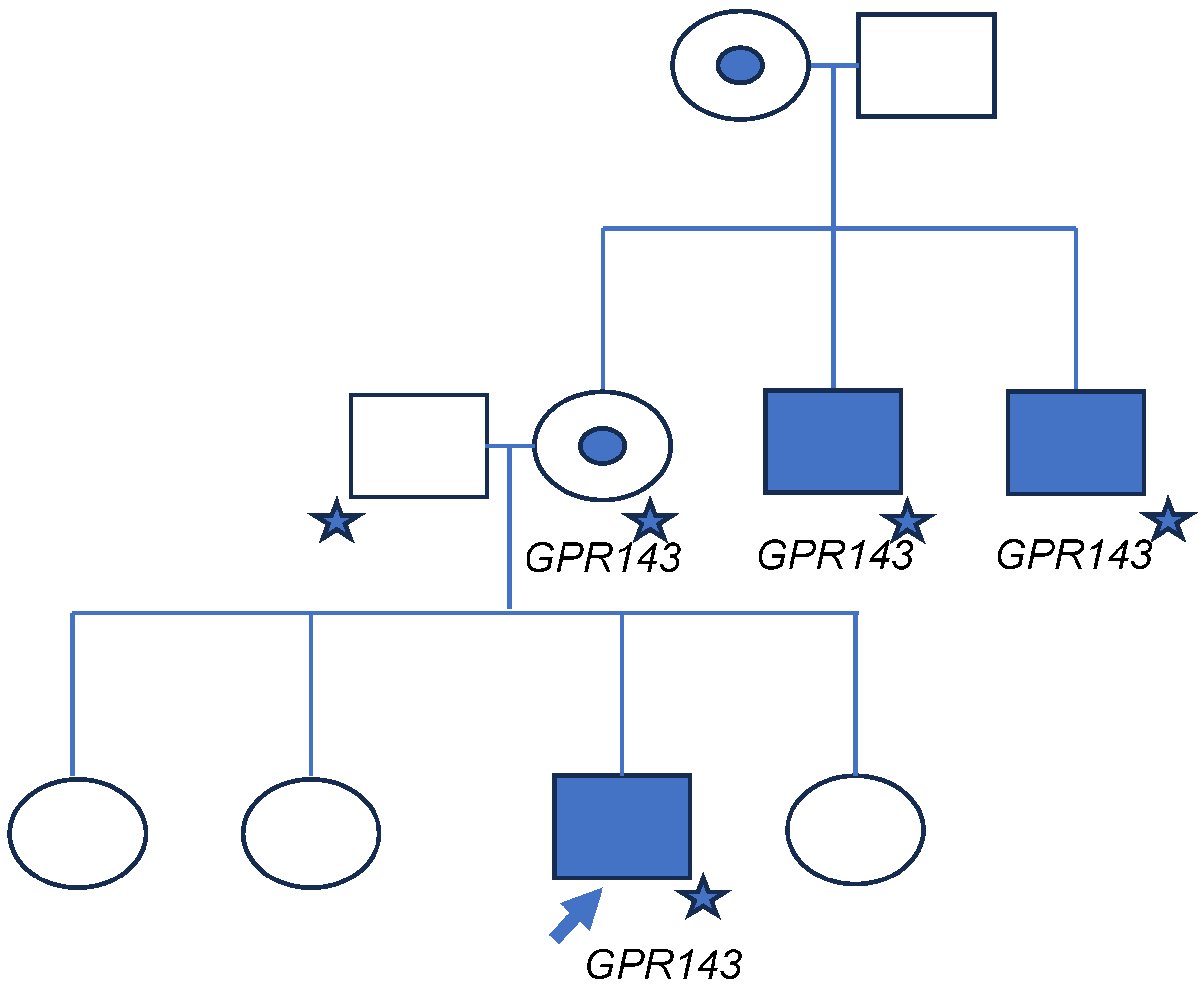 GPR143-Associated Ocular Albinism in a Hispanic Family and Review of ...