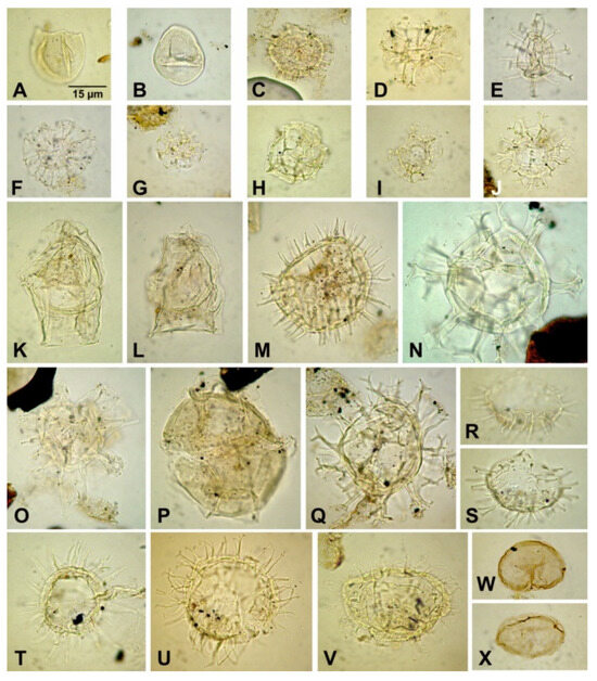 Foraminiferal and Palynological Records of an Abrupt Environmental ...