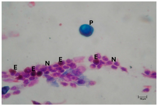Rhinitis in the Geriatric Population: Epidemiological and Cytological ...