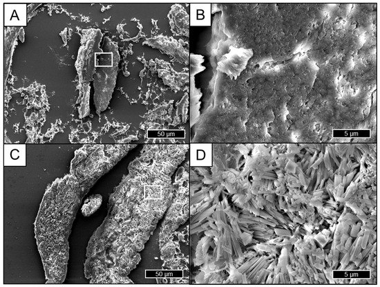 High-Resolution Imaging Methods for Identification of Calcium Crystal ...
