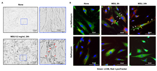 Atherogenic Activation of Human Vascular Smooth Muscle Cells by ...