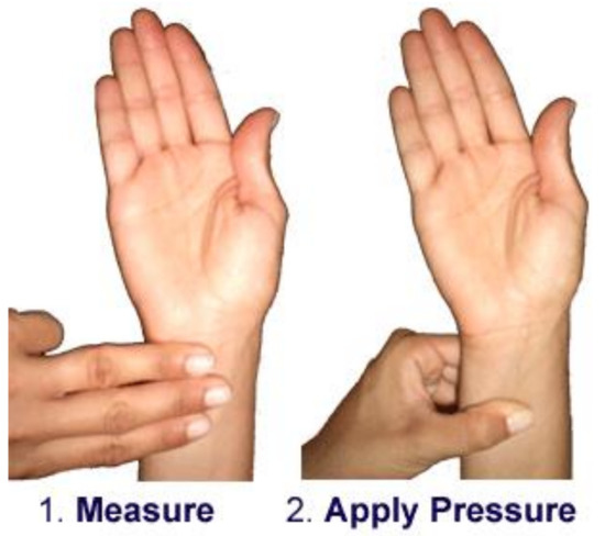 Comparison of the Effects of Hand Reflexology versus Acupressure on ...