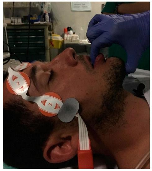 Drug-Induced Sleep Endoscopy: Technique, Indications, Tips and Pitfalls