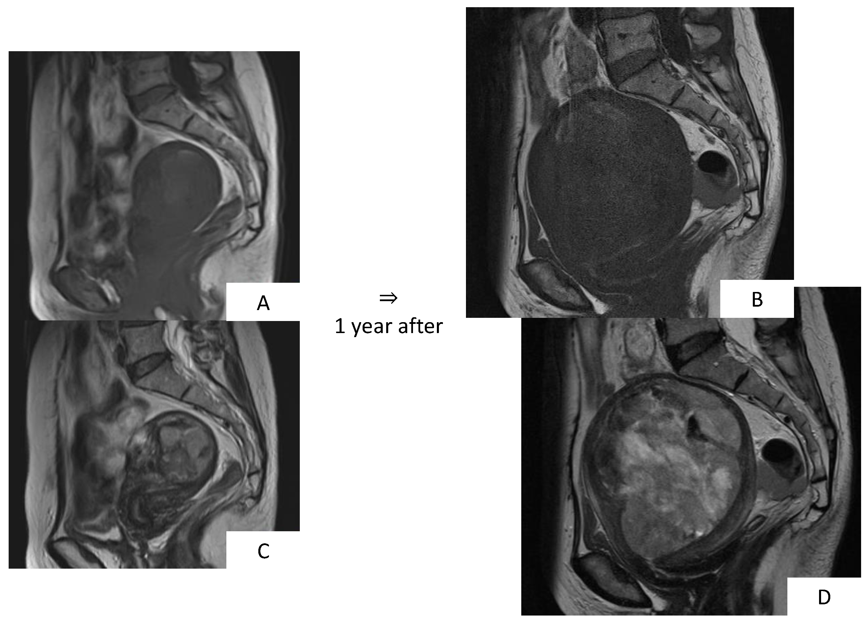 Healthcare Free Full Text Differential Diagnosis Of Uterine