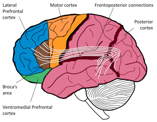 Healthcare | Free Full-Text | Imagination in Autism: A Chance to ...