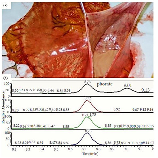 A Rare Case of Suicide by Ingestion of Phorate: A Case Report and a ...