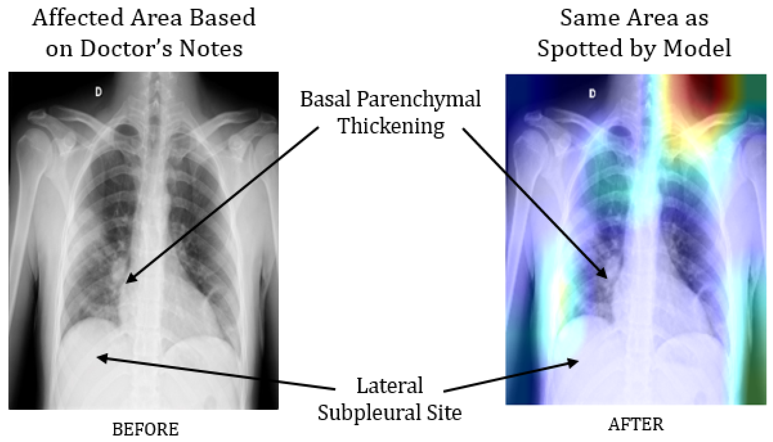 Covid Detection Using Chest X Ray at Maria Couch blog Covid Detection Using Chest X Ray at Maria Couch blog