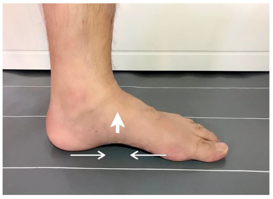 Effect of Incorporating Short-Foot Exercises in the Balance ...