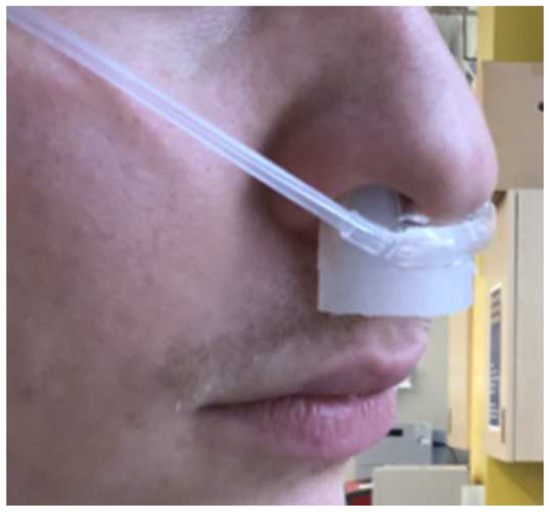 Home Respiratory Care: Design of a Prototype for Continuous Measurement ...