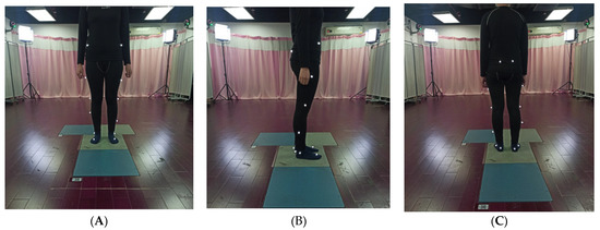 Is Static Alignment a Good Predictor of Dynamic Alignment after Total ...