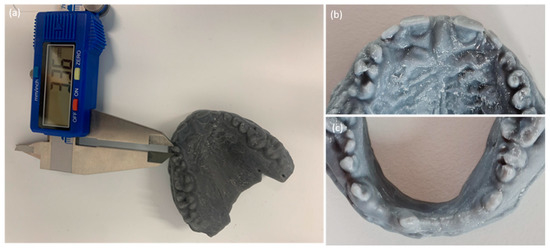Aesthetic and Functional Rehabilitation of Patients with Genetic ...