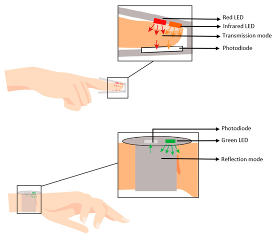 Diagnostic Features and Potential Applications of PPG Signal in ...