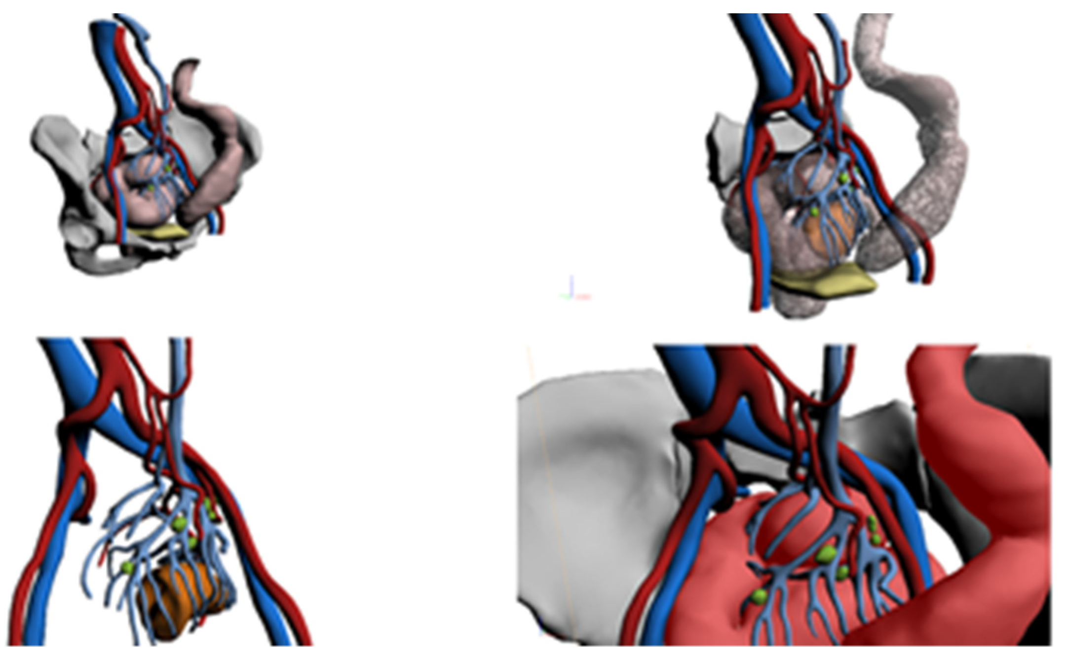 Healthcare | Free Full-Text | Efficacy of High-Resolution Preoperative ...
