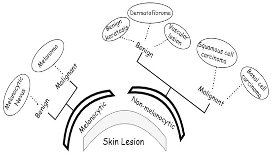 Detection of Skin Cancer Based on Skin Lesion Images Using Deep Learning