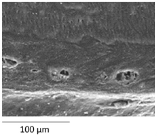 Morphological Study of Dental Structure in Dentinogenesis Imperfecta ...