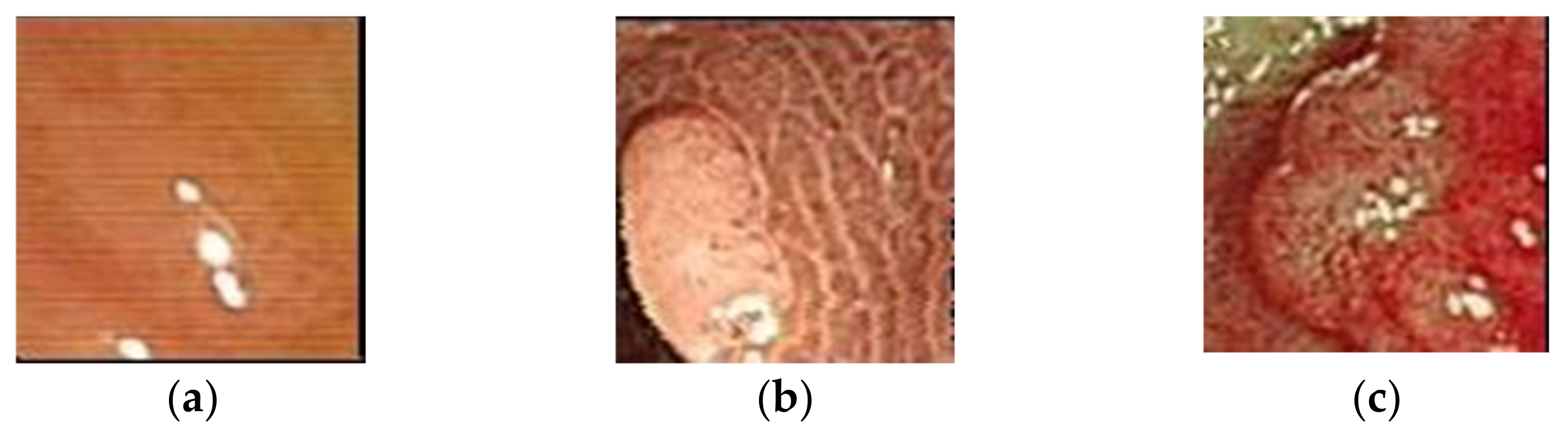 Rapid Polyp Classification in Colonoscopy Using Textural and ...