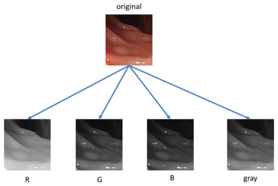 Rapid Polyp Classification in Colonoscopy Using Textural and Convolutional Features
